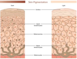 Best Guide to Melasma - Skin Spot